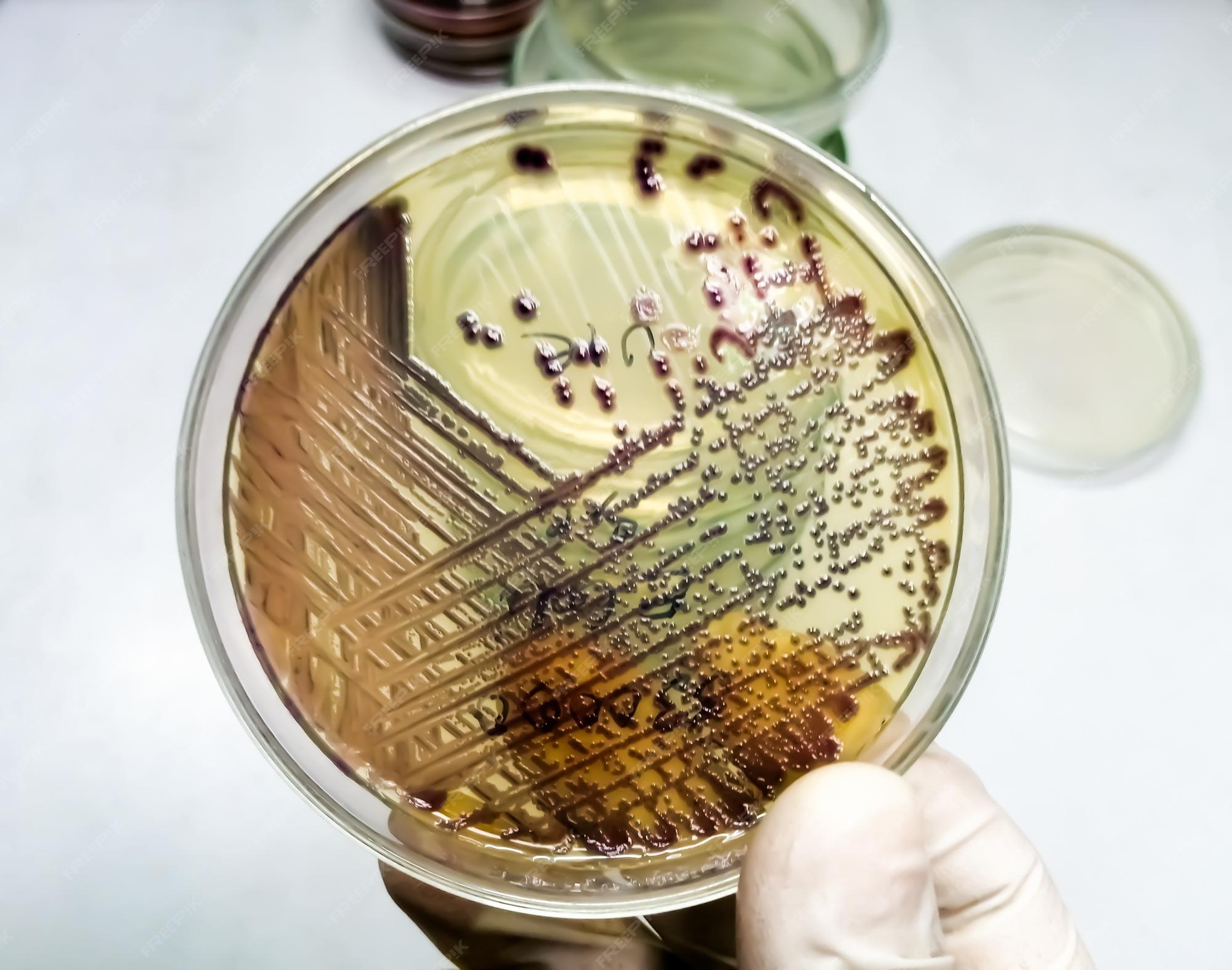 Premium Photo Bacteria Colony Of Escherichia Coli Or Ecoli In Culture Media Plate