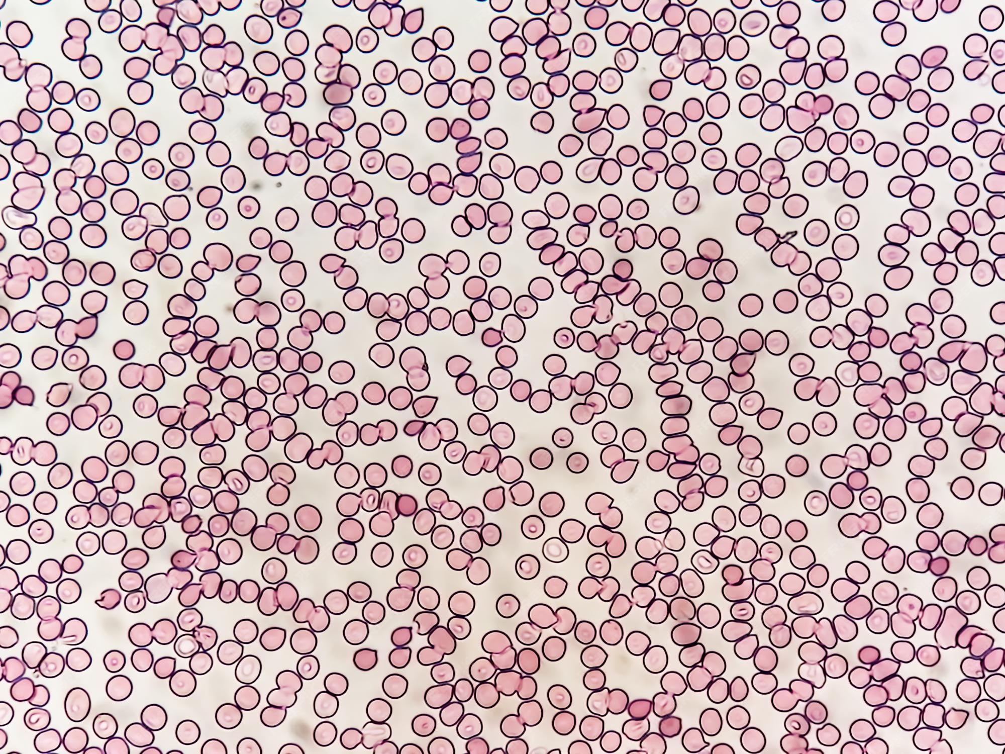 Platelets Slide