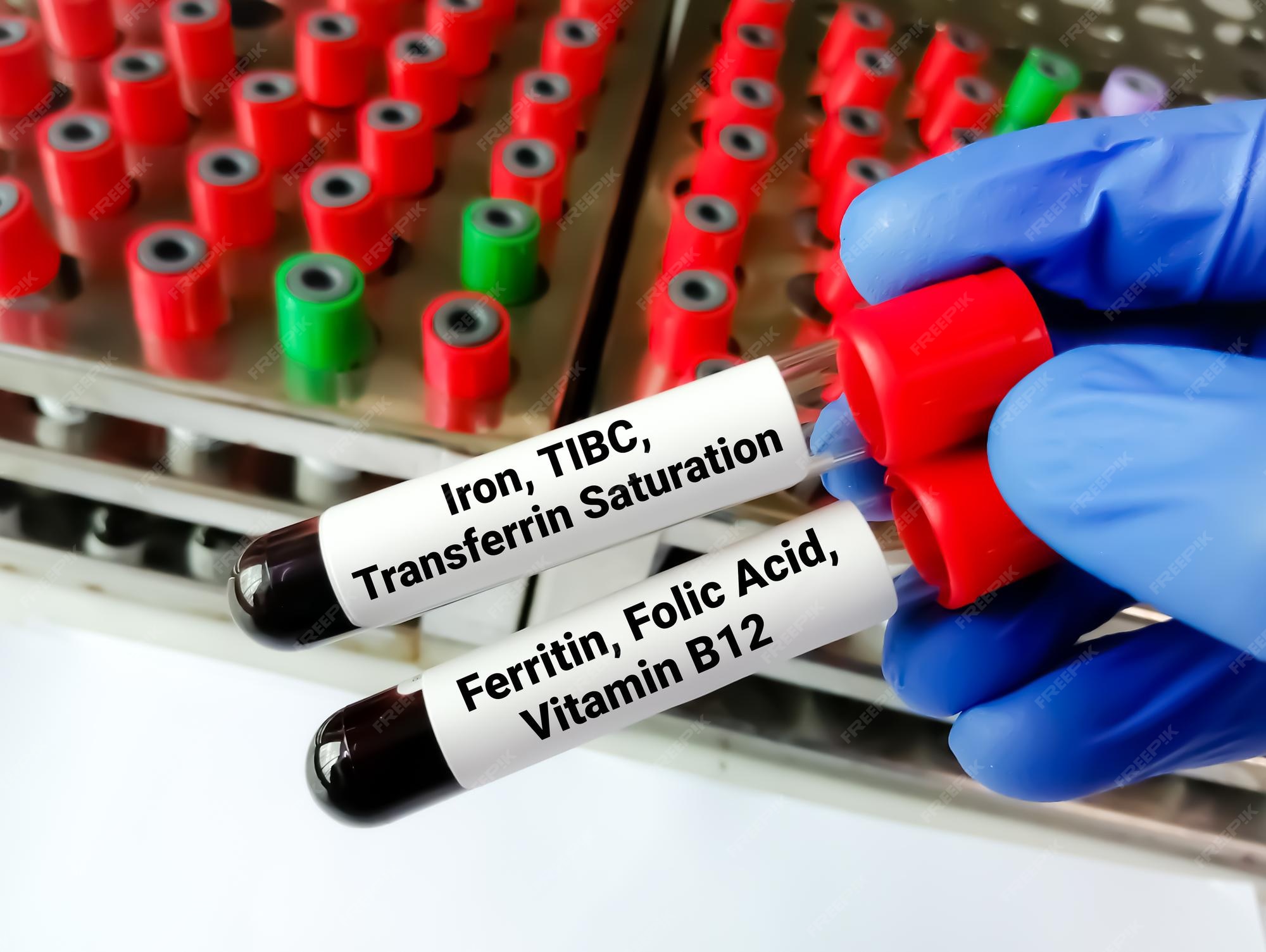 Premium Photo Iron Tibc Transferrin Saturation Ferritin Folic Acid