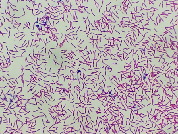 Premium Photo | Microscopic view of gram stain showing rod shape ... Premium Photo | Microscopic view of gram stain showing rod shape ...