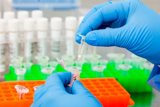 Premium Photo | Scientist hands while extracting dna using the spin ... Premium Photo | Scientist hands while extracting dna using the spin ...