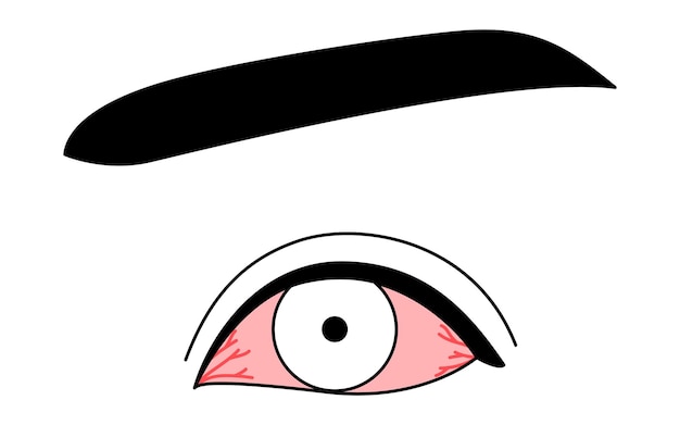 Premium Vector | Medical clipart line drawing illustration of eye ... Premium Vector | Medical clipart line drawing illustration of eye ...