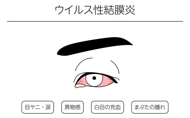 Premium Vector | Medical clipart line drawing illustration of eye ... Premium Vector | Medical clipart line drawing illustration of eye ...