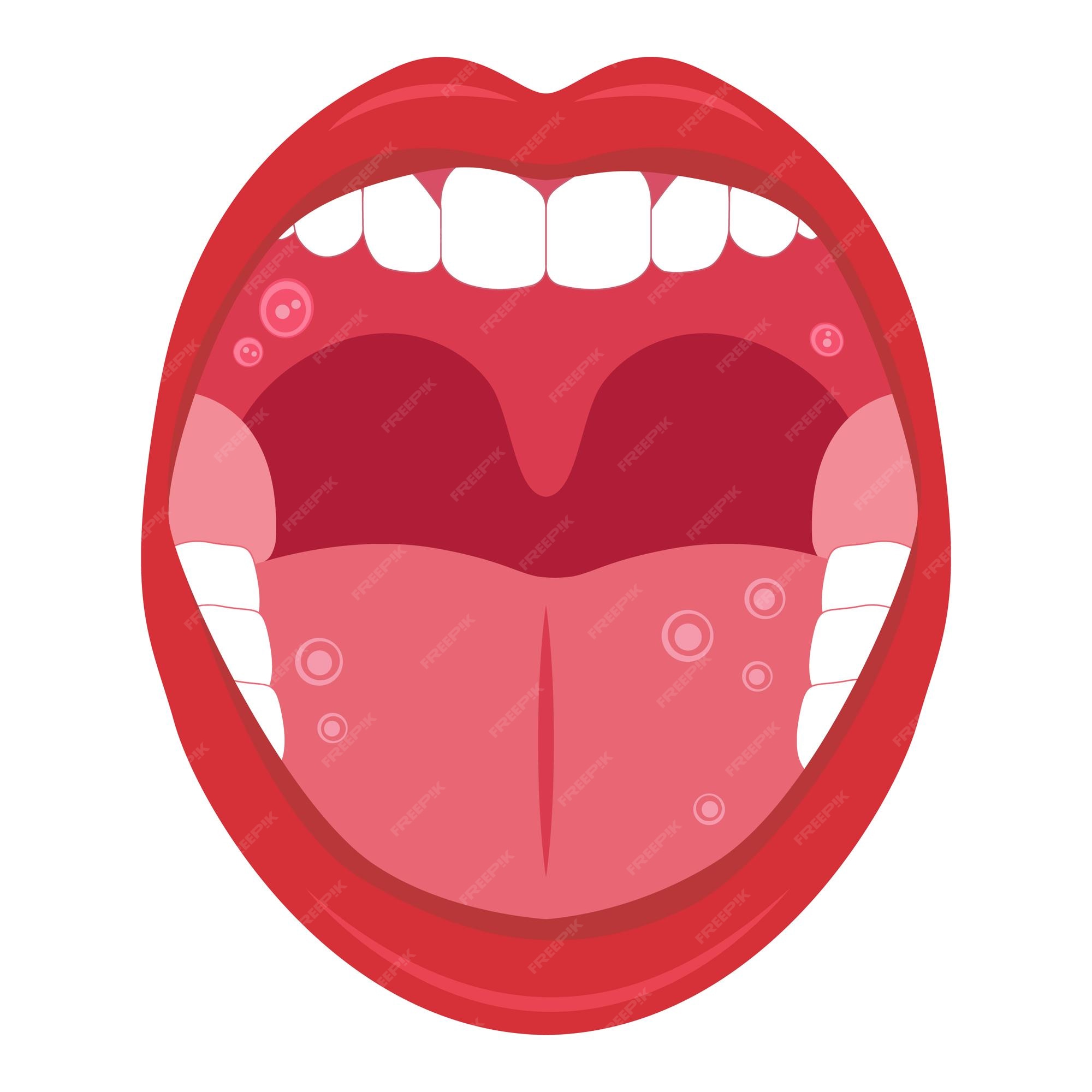 Top 107 Mouth Ulcer Cartoon