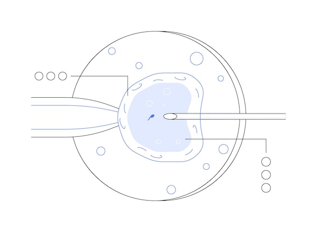 Premium Vector | In vitro fertilization abstract concept vector ... Premium Vector | In vitro fertilization abstract concept vector ...
